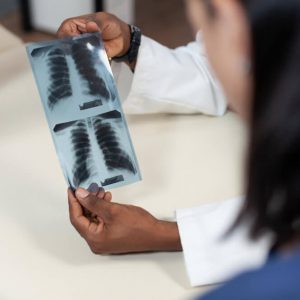 Chest X-ray normal vs abnormal Everything you need to know - Viascan of ...